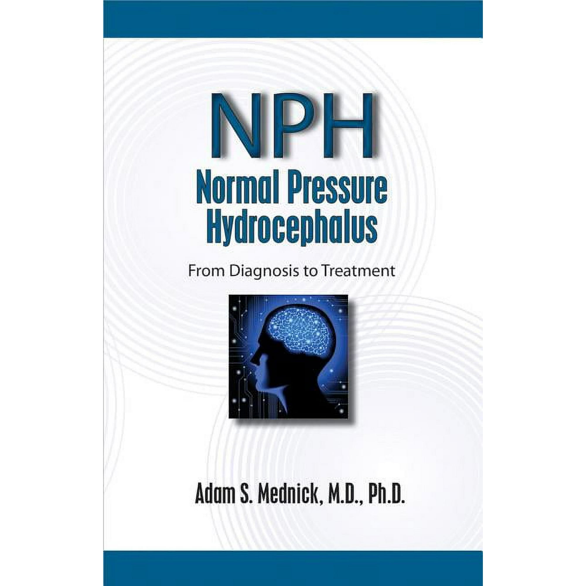 Normal Pressure Hydrocephalus