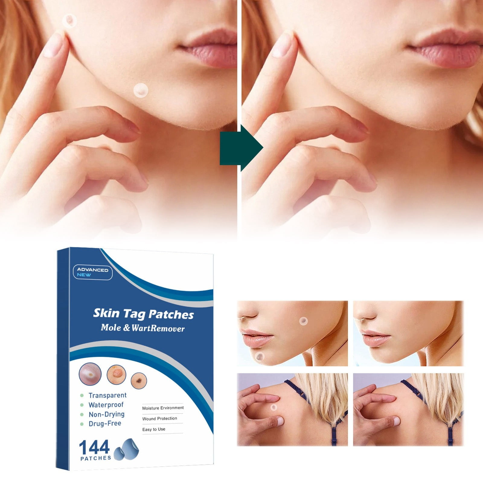Nose Pore Patches Hydrocolloid 2024 Noise&pimples Patches Skin Removal