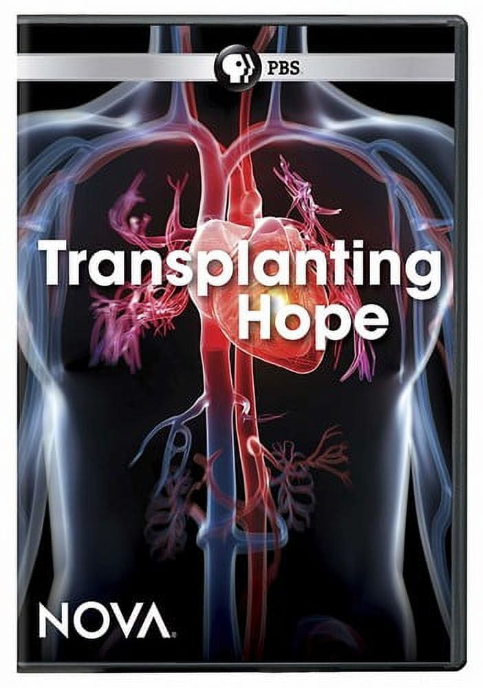 Nova: Transplanting Hope (DVD), PBS (Direct), Documentary - Walmart.com