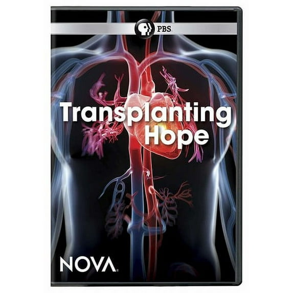 Nova: Transplanting Hope (DVD), PBS (Direct), Documentary - Walmart.com