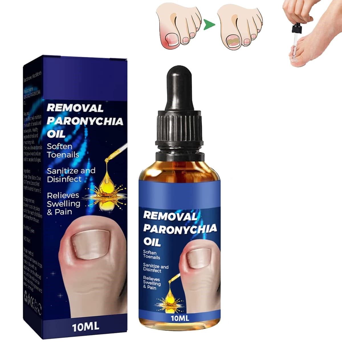 Nspiel Toenailcare Removal Paronychia Oil, Ingrown Toenail Treatment ...