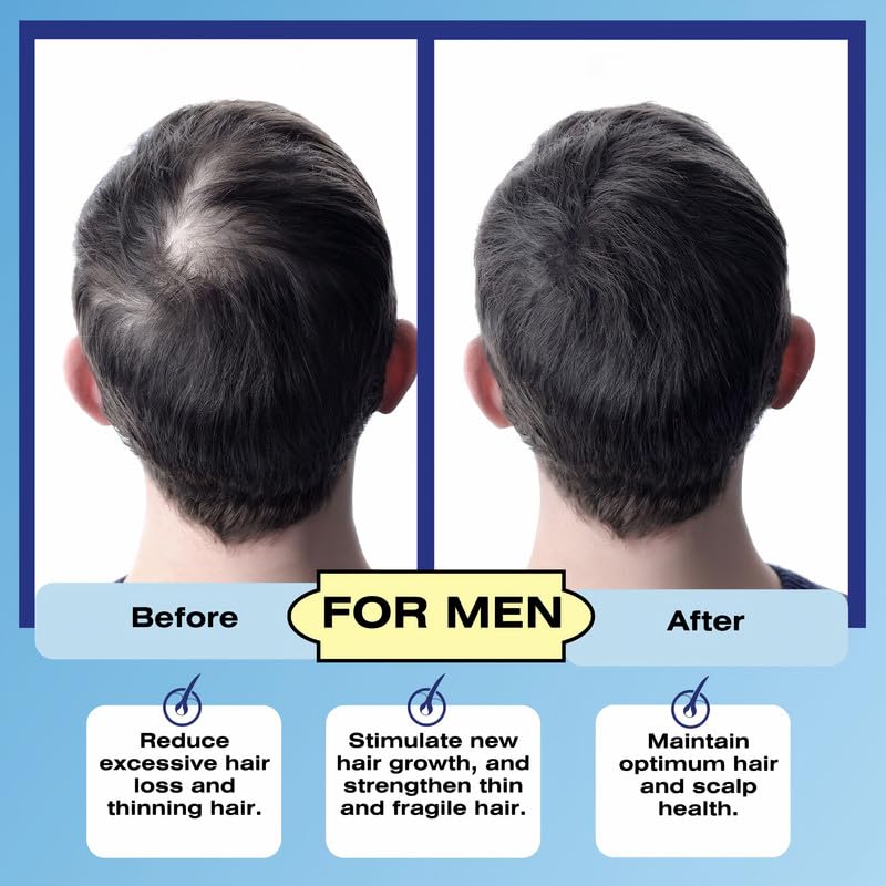 Numinox - Follicle Revitalizer 8.45 oz (250 ml) DHT Blocker for Men ...