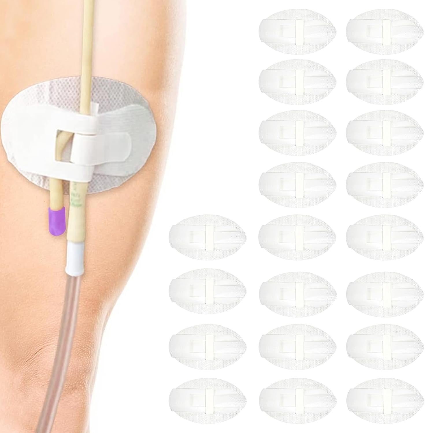 Numjaw 20Pcs Catheter Stabilization Device, Non-Woven Catheter Fixation ...