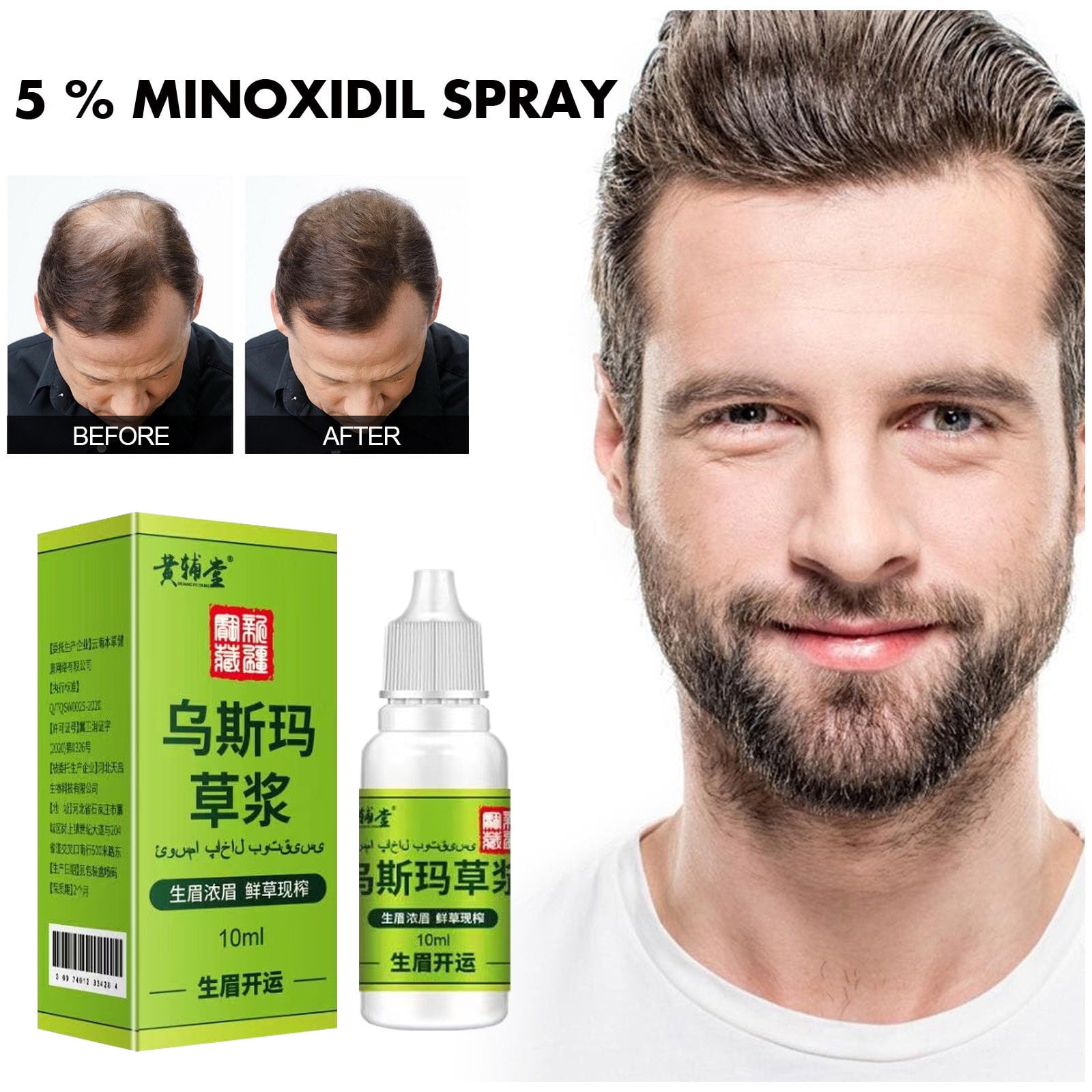 NuoWeiTong Facial Serum,Grass Hair Care Liquid, Pure Grass Hair Liquid ...