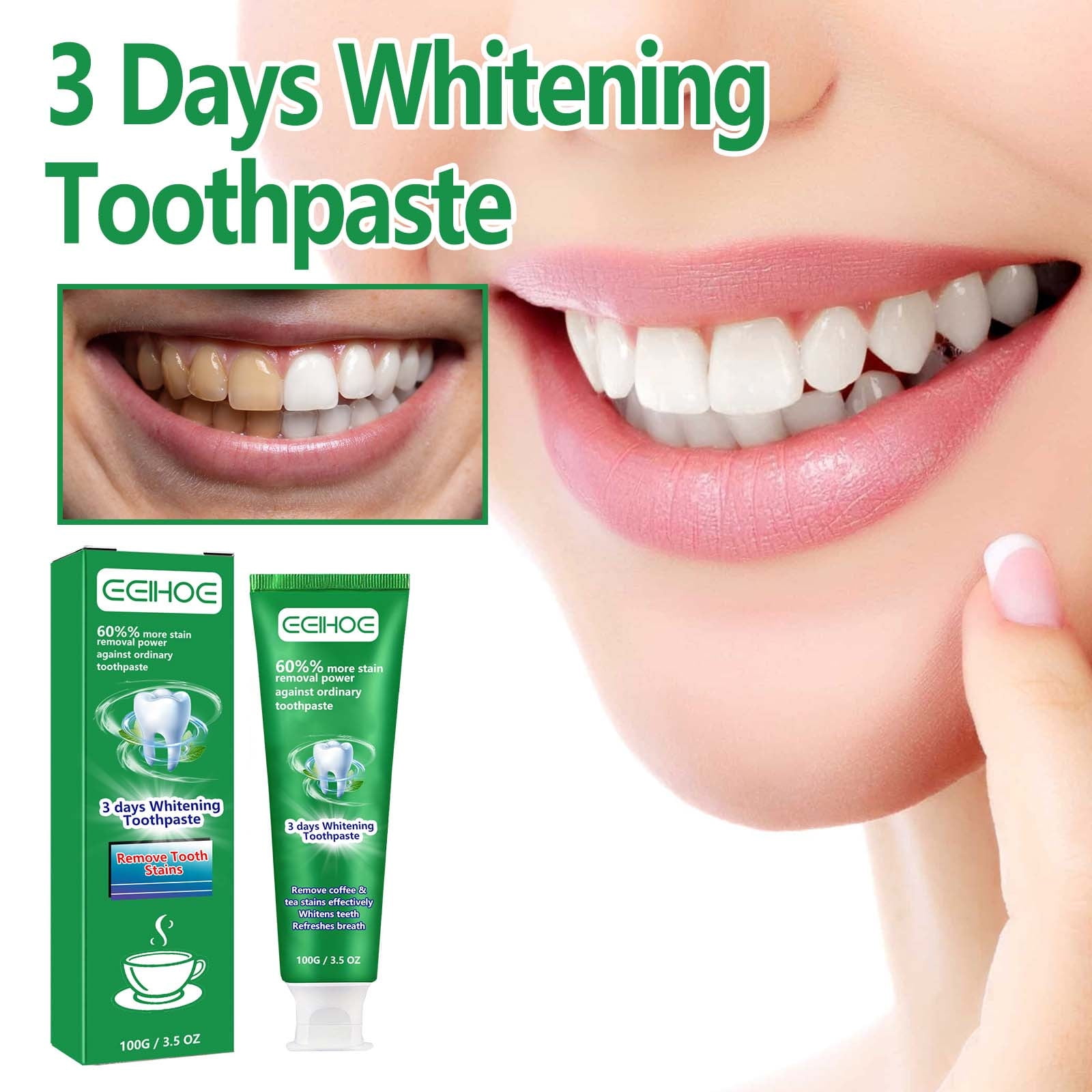 NuoWeiTong Parodontax Toothpaste,The Cleaning Effect Freshens The ...