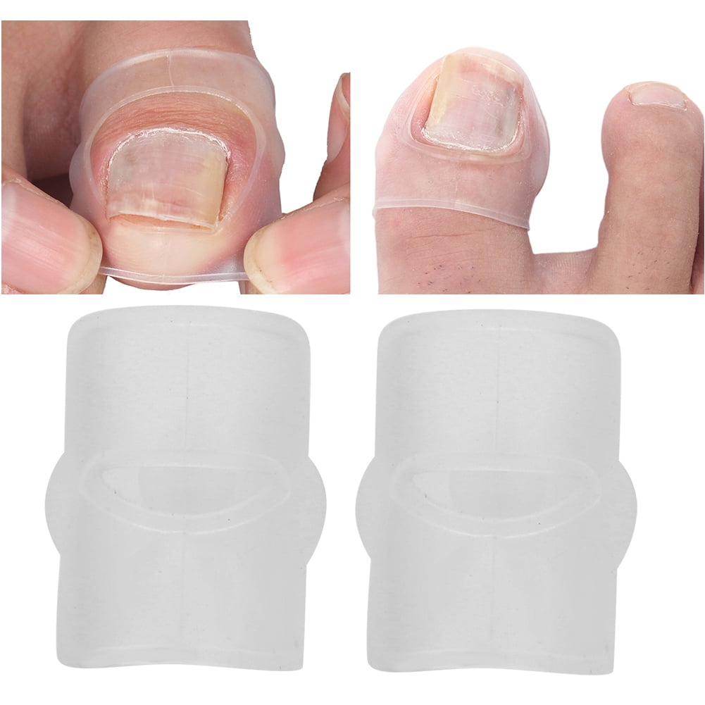 OTVIAP Foot Care Tool,2pcs Silicone Ingrown Toenail Correcting Tool ...