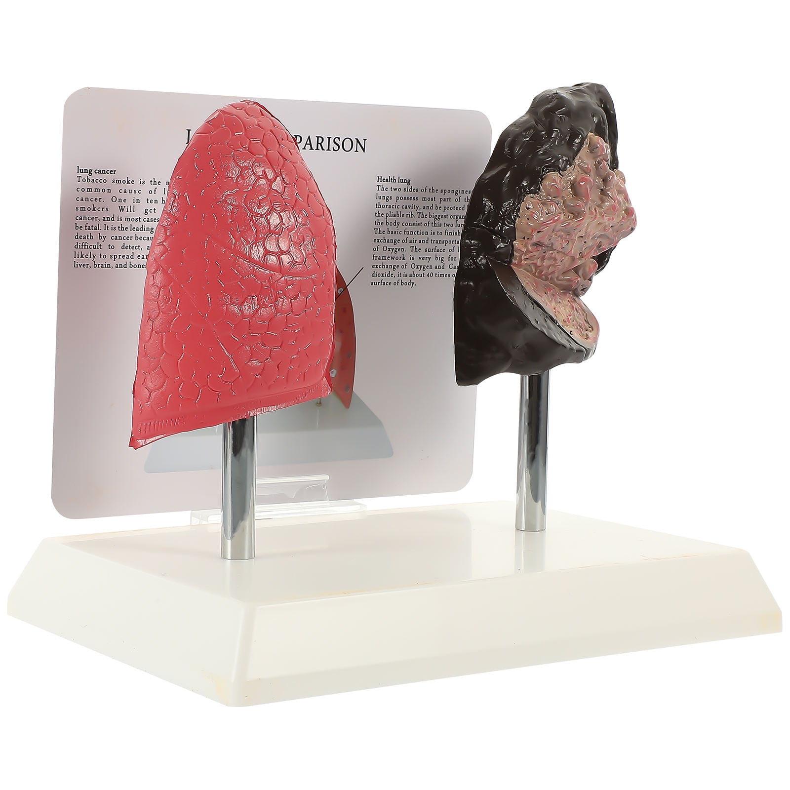 Tineasur Lung Anatomy Model Pathological for Medical Education Multi ...