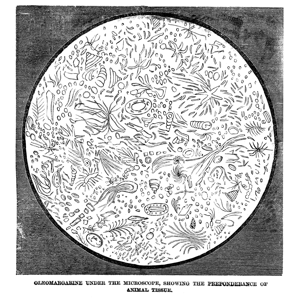 Oleomargarine 1884. N'Oleomargarine Under The Microscope Showing The ...