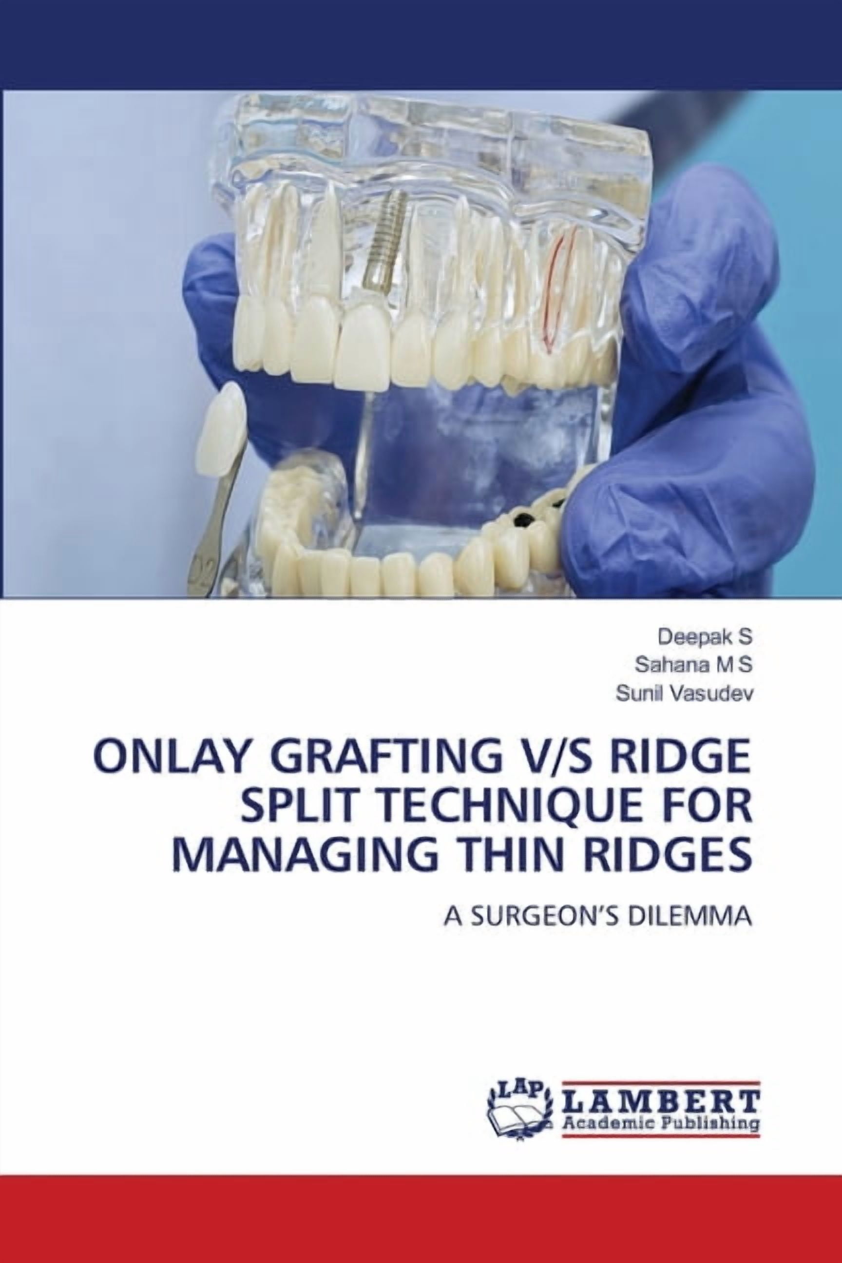 Onlay Grafting V/S Ridge Split Technique for Managing Thin Ridges ...