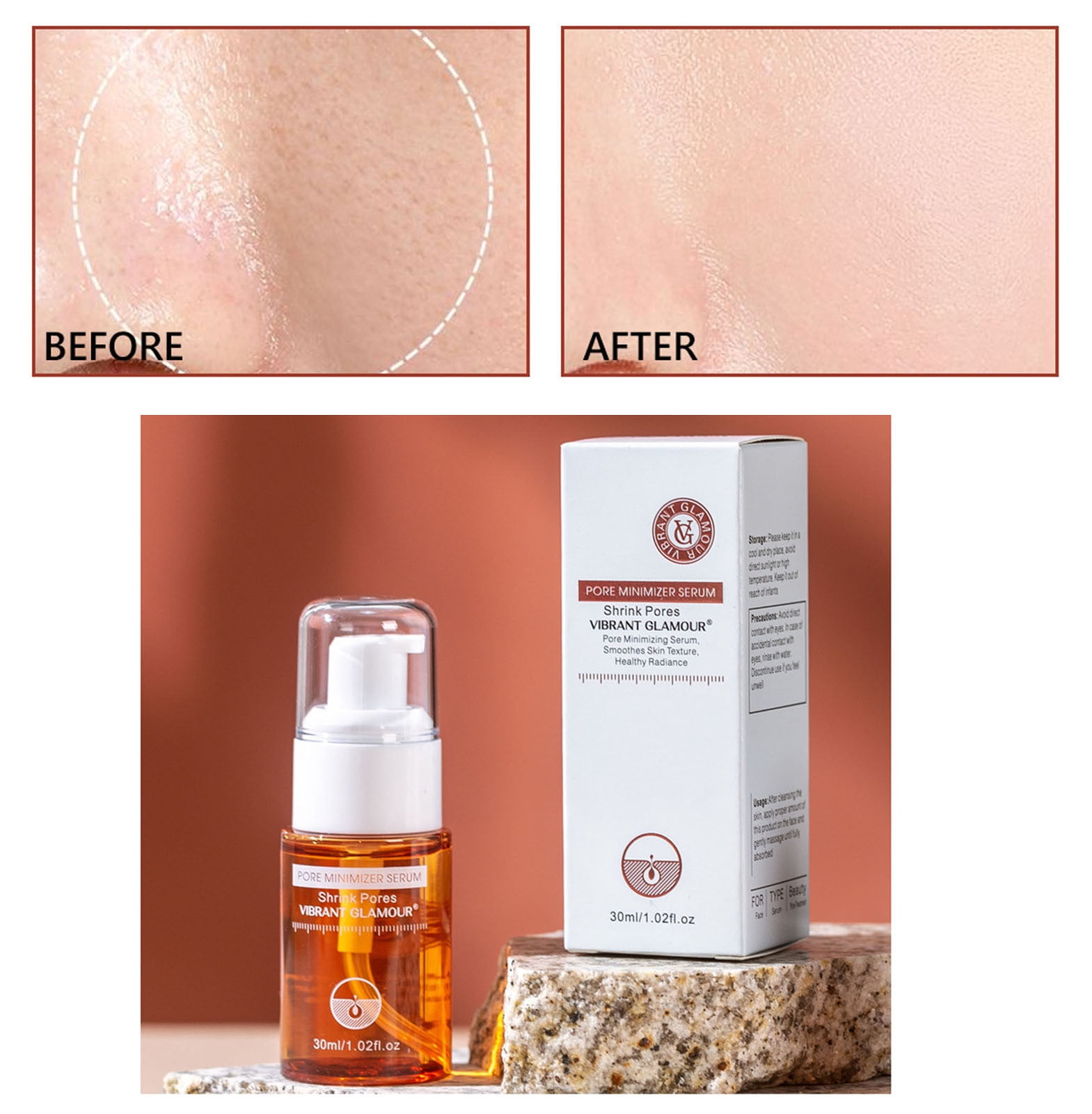 Openpig Clearance Salicylic Acid，Acne Mark Closed Mouth And Repair 30ML ...