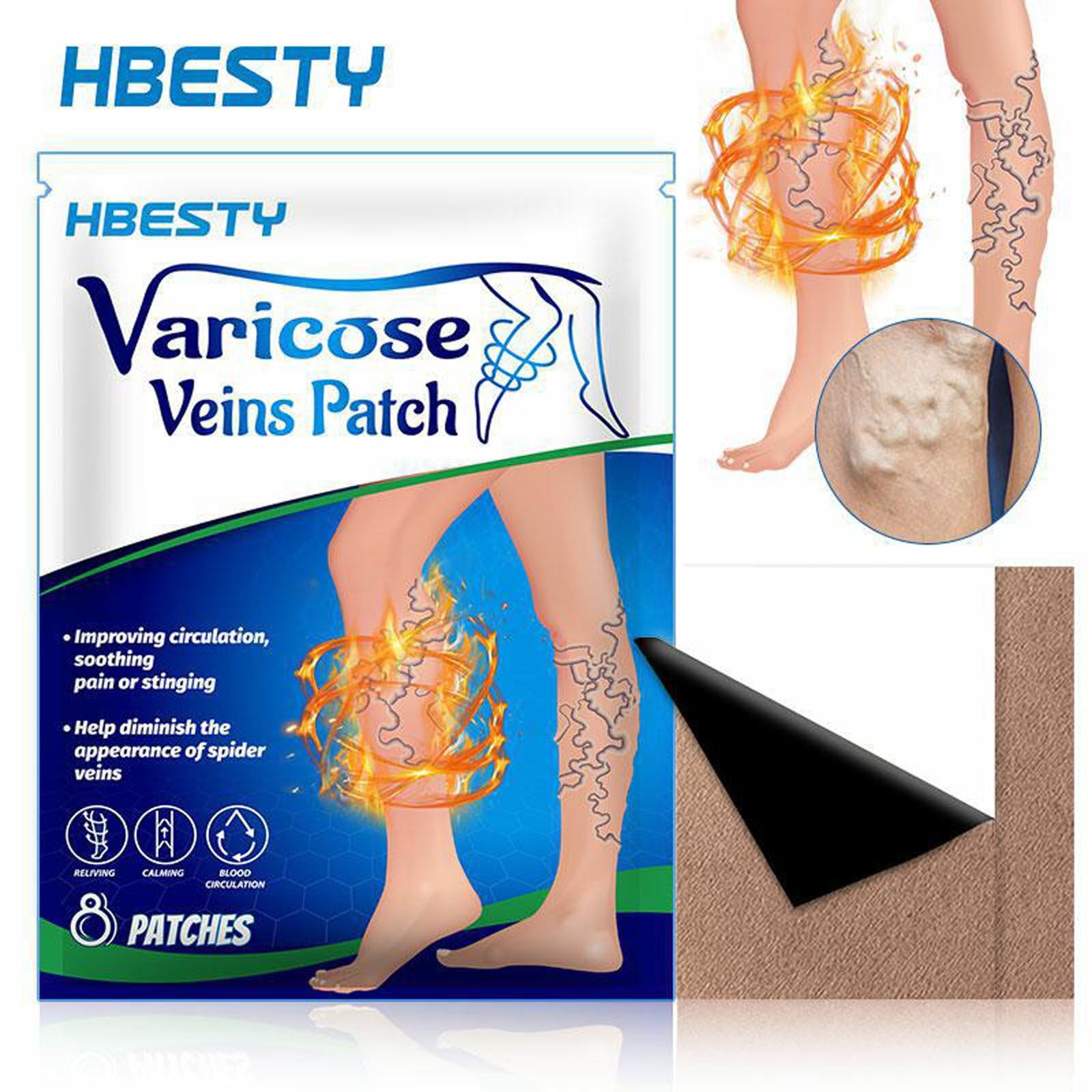 Openpig Clearance Varicose Veins Patch,Spider Vein Legs Spider Vein Edema Neuralgia Leg Pain ...