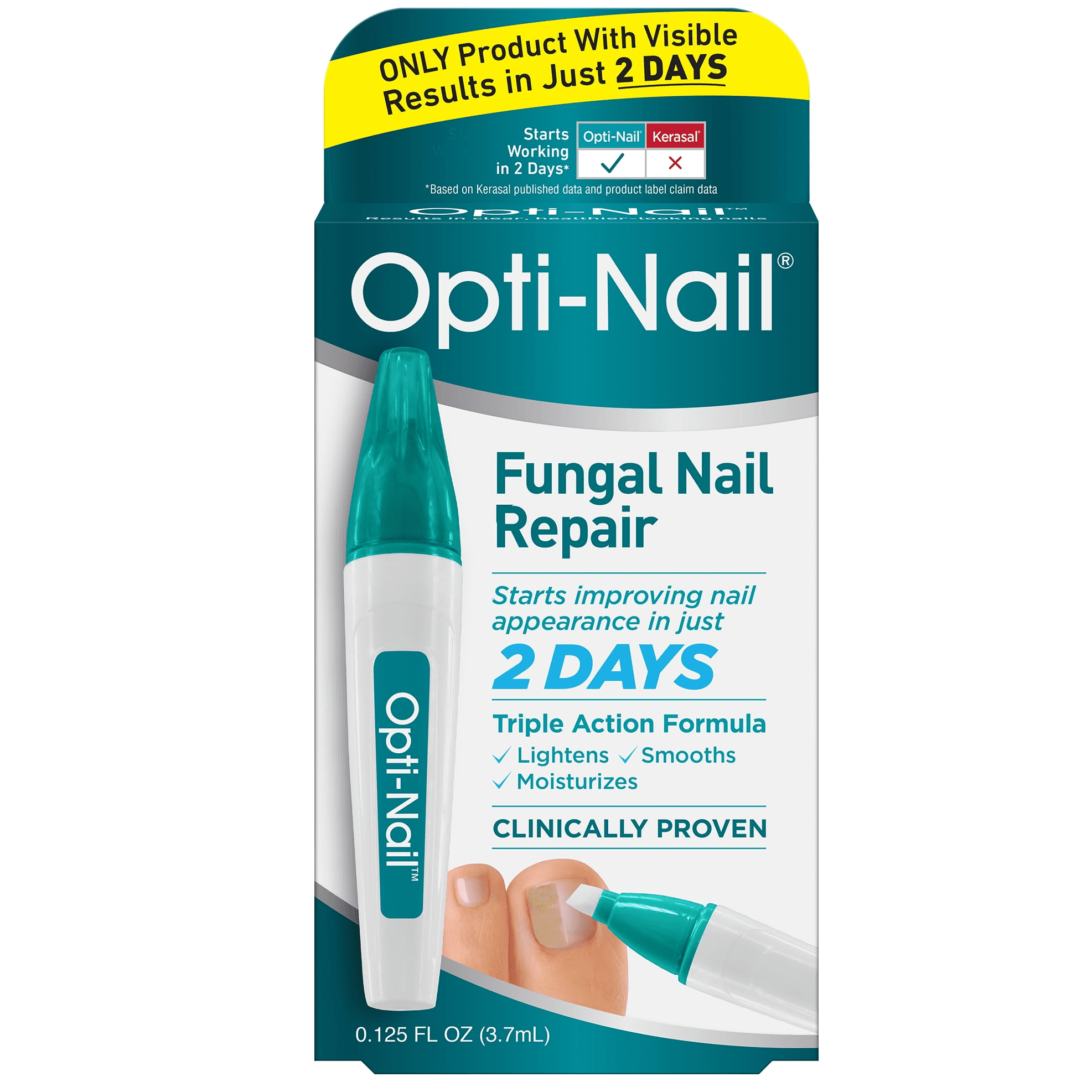 Opti-Nail Fungal Nail Repair Pen: Finger Fungi Solution for Nail Care ...