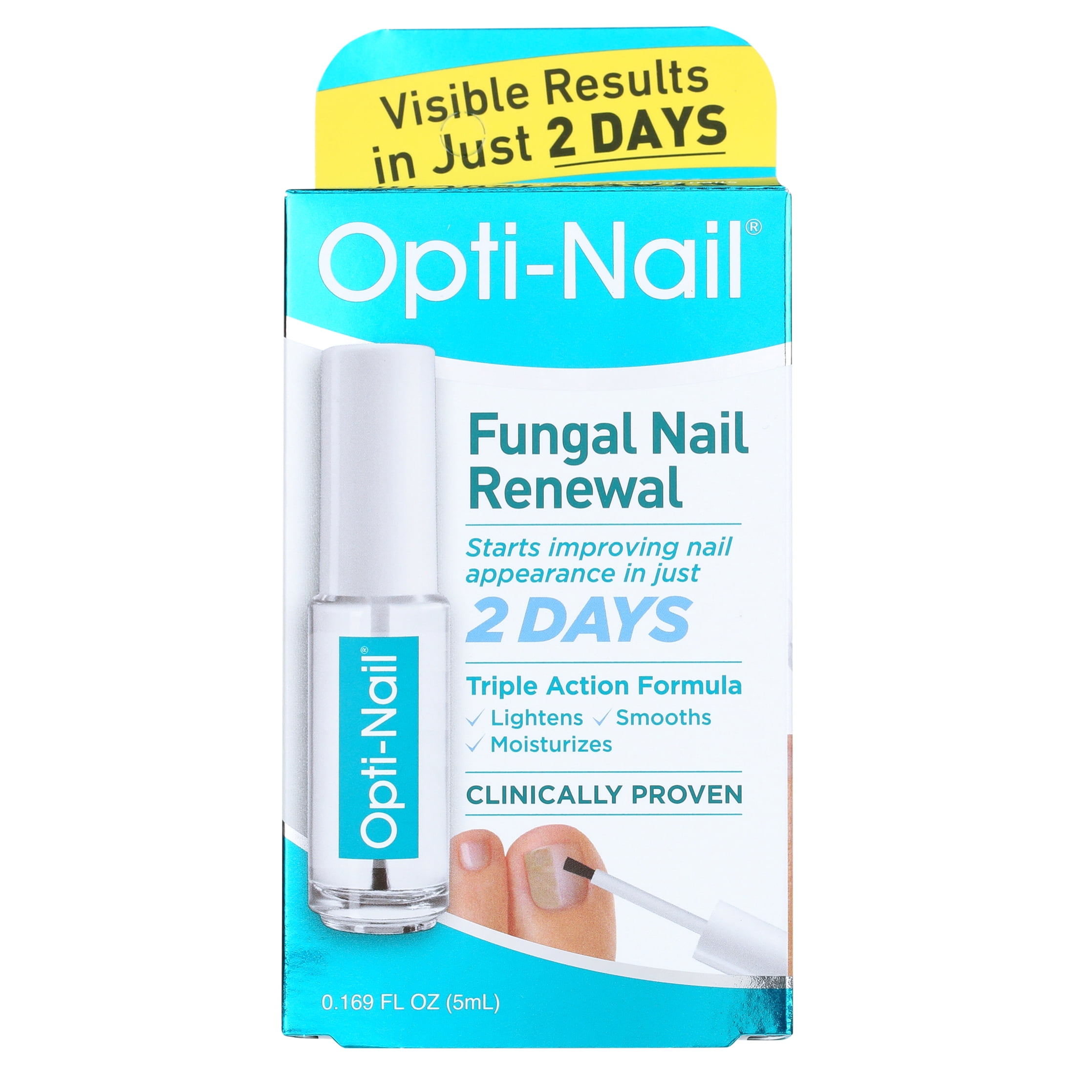 Opti-Nail Antifungal Repairs Discolored & Damaged Nails by Fungus ...