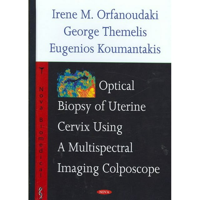 Optical Biopsy of Uterine Cervix Using a Multispectral Imaging ...
