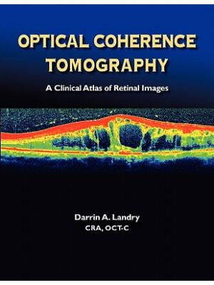 Optical Coherence Tomography a Clinical Atlas of Retinal Images ...