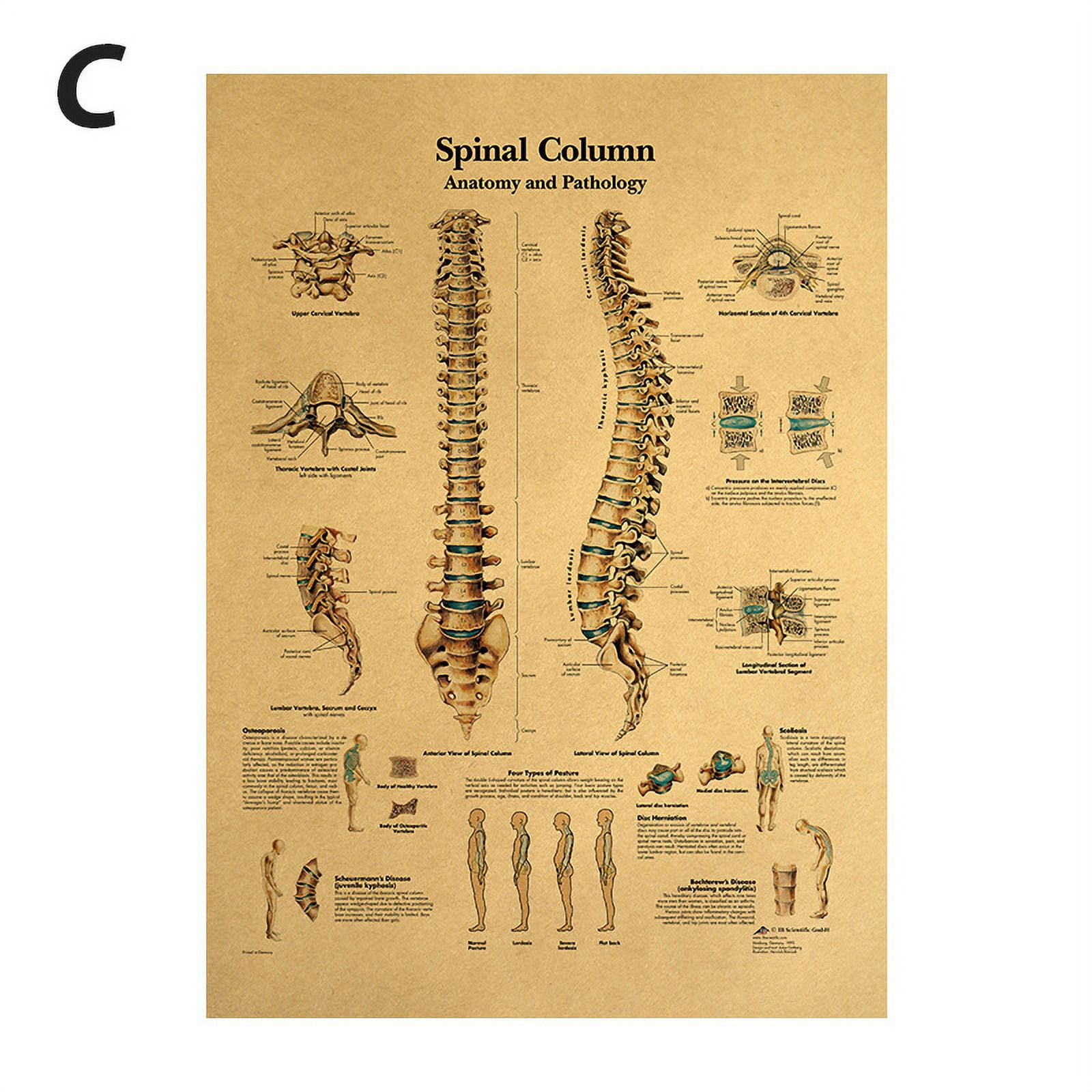 (Option C) Spinal Column Chart Poster Human Anatomy Knee Posters Wall ...