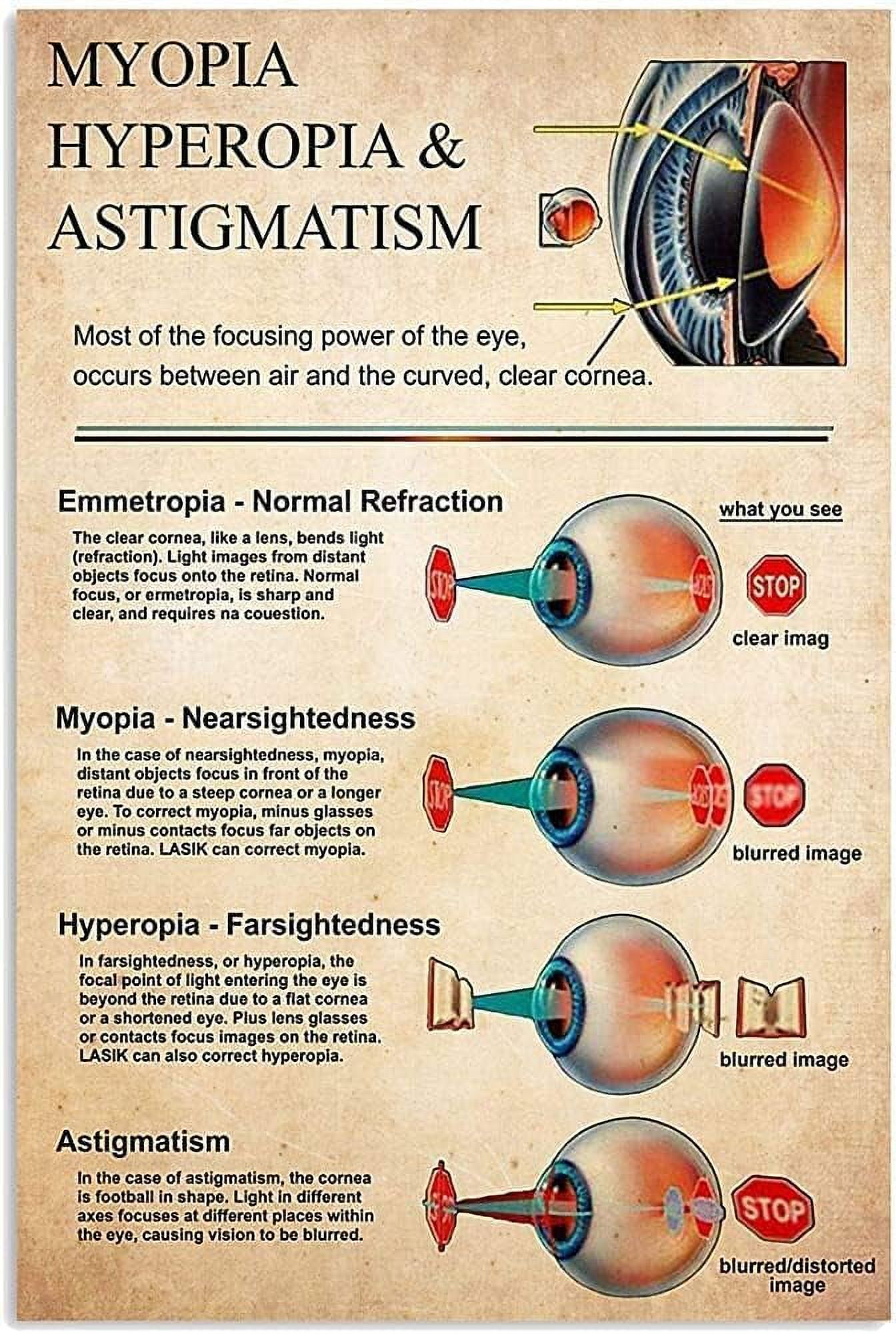 Optometrist Knowledge Aluminum Metal Signs Retro Myopia Hyperopia & Astigmatism Poster Hospital ...
