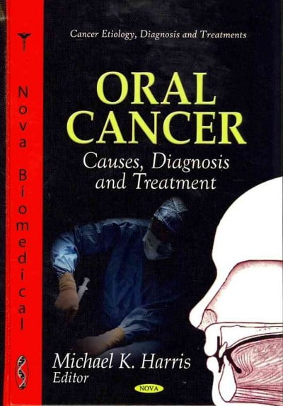 Oral Cancer : Causes, Diagnosis and Treatment - Walmart.com