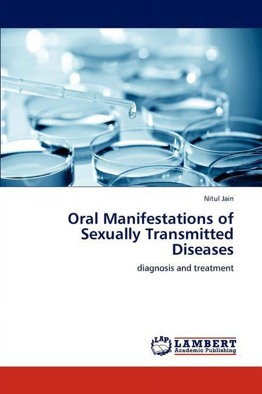Oral Manifestations of Sexually Transmitted Diseases (Paperback ...