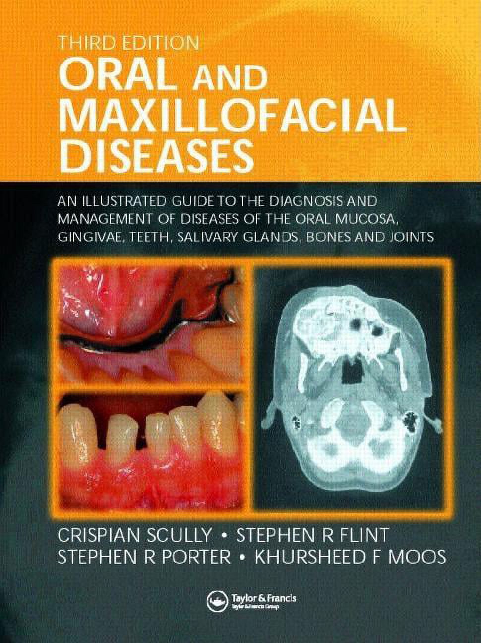 Oral and Maxillofacial Diseases: An Illustrated Guide to Diagnosis and ...