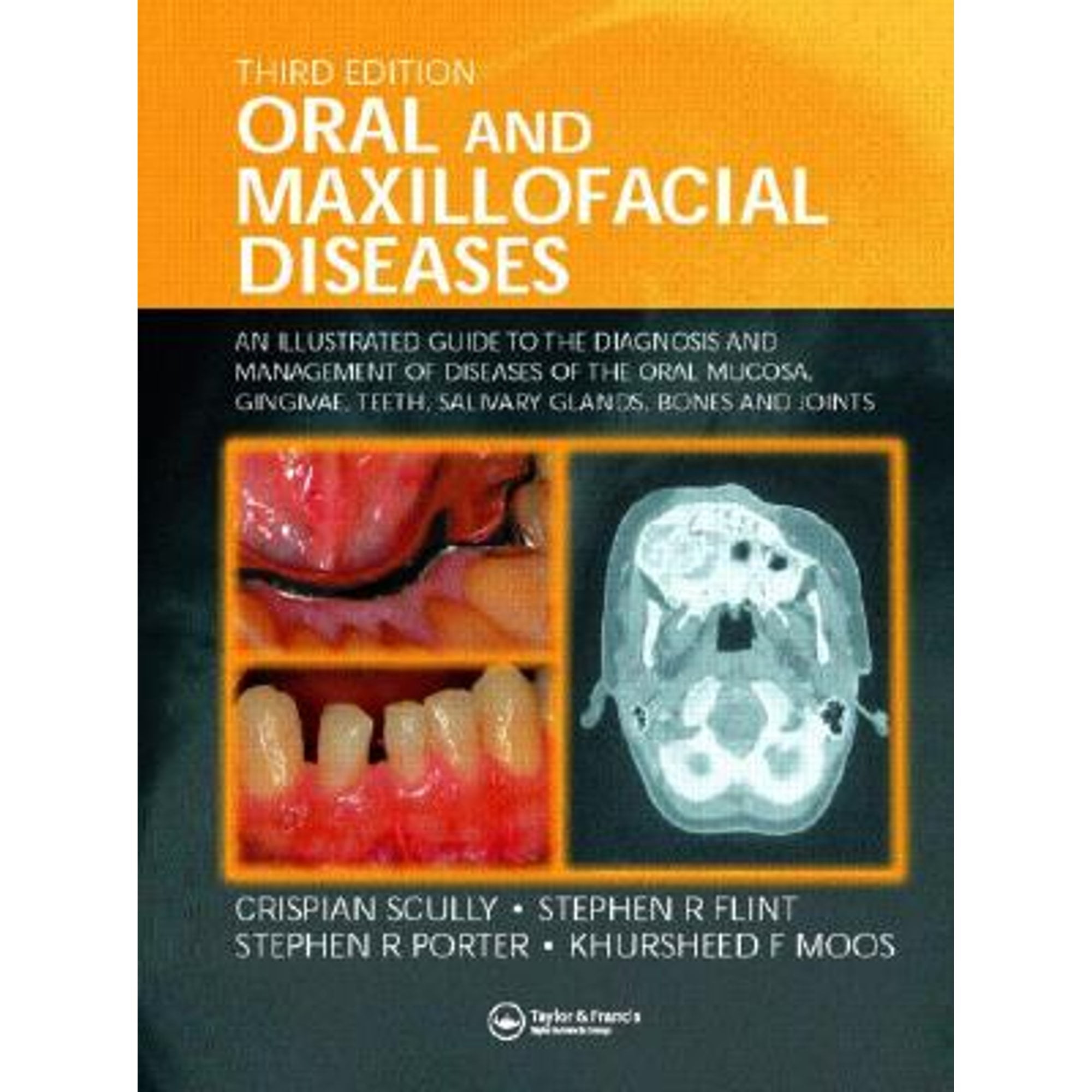 Oral and Maxillofacial Diseases: An Illustrated Guide to Diagnosis and ...