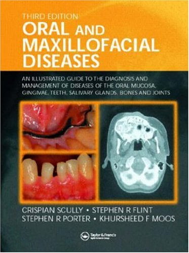Pre-Owned Oral and Maxillofacial Diseases : An Illustrated Guide to Diagnosis Management of the ...