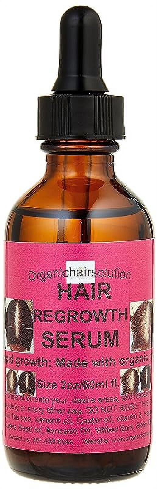 Organic Hair Solution -Organic Hair Solution -Edge growth Serum-Oil ...