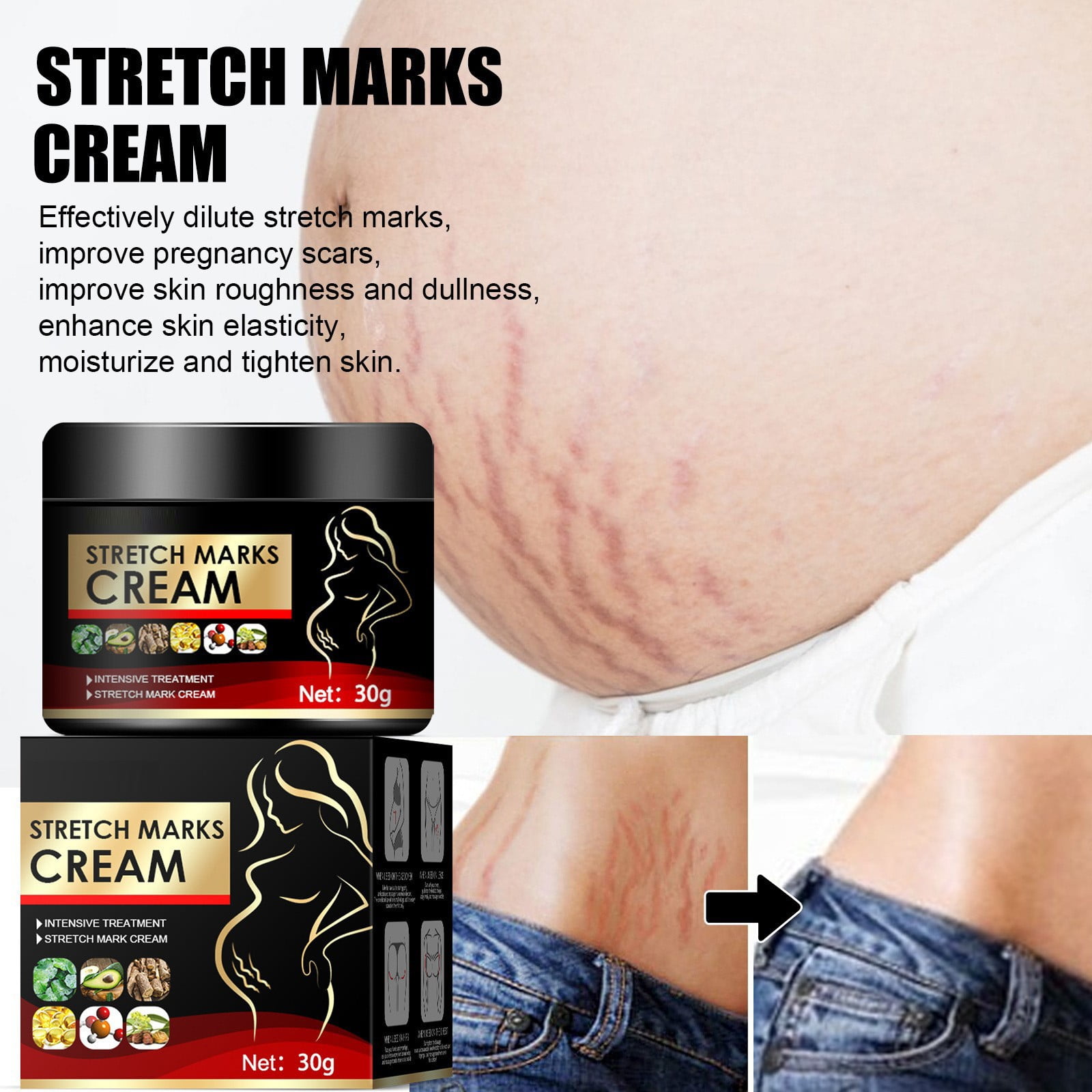 ECPECAD Organic Skin & Scar Balm Wound & C-Section Recovery Skin Care ...