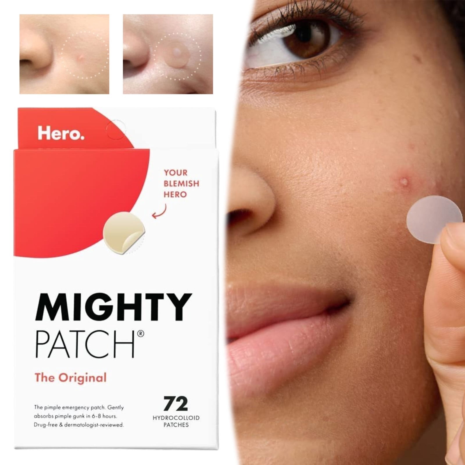 Original Hydrocolloid For Covering Pimples And Blemishes For And Skin ...