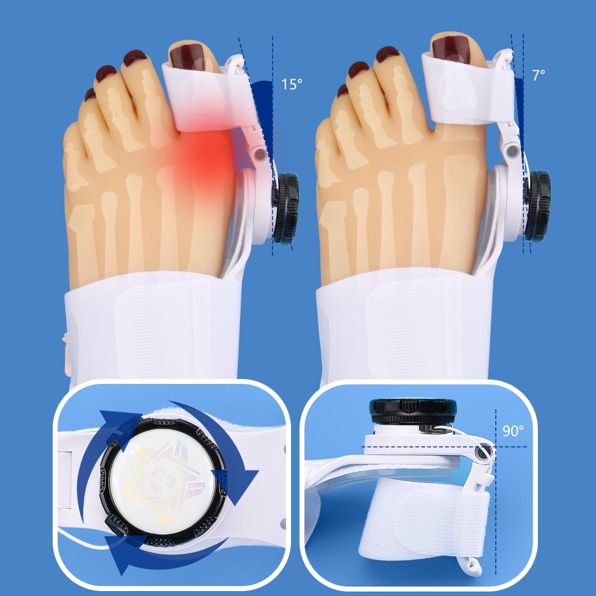 Orthopedic Bunion Corrector Device Foot Relief Hallux Valgus Toe ...