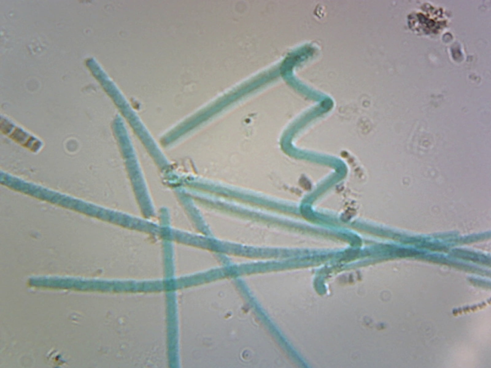 Oscillatoria; Filamentous Bacteria; Shows Simple Unbranched Filaments ...