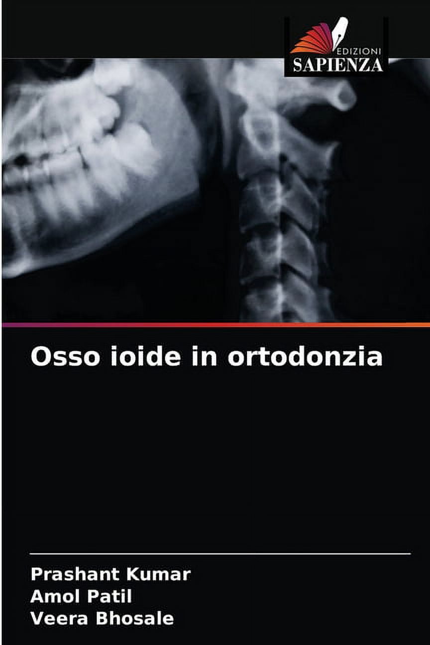 Osso ioide in ortodonzia (Paperback) - Walmart.com