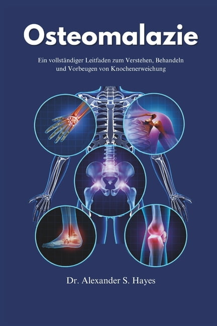 The Bone Wellness Guide Osteomalazie: Ein vollständiger Leitfaden zum ...