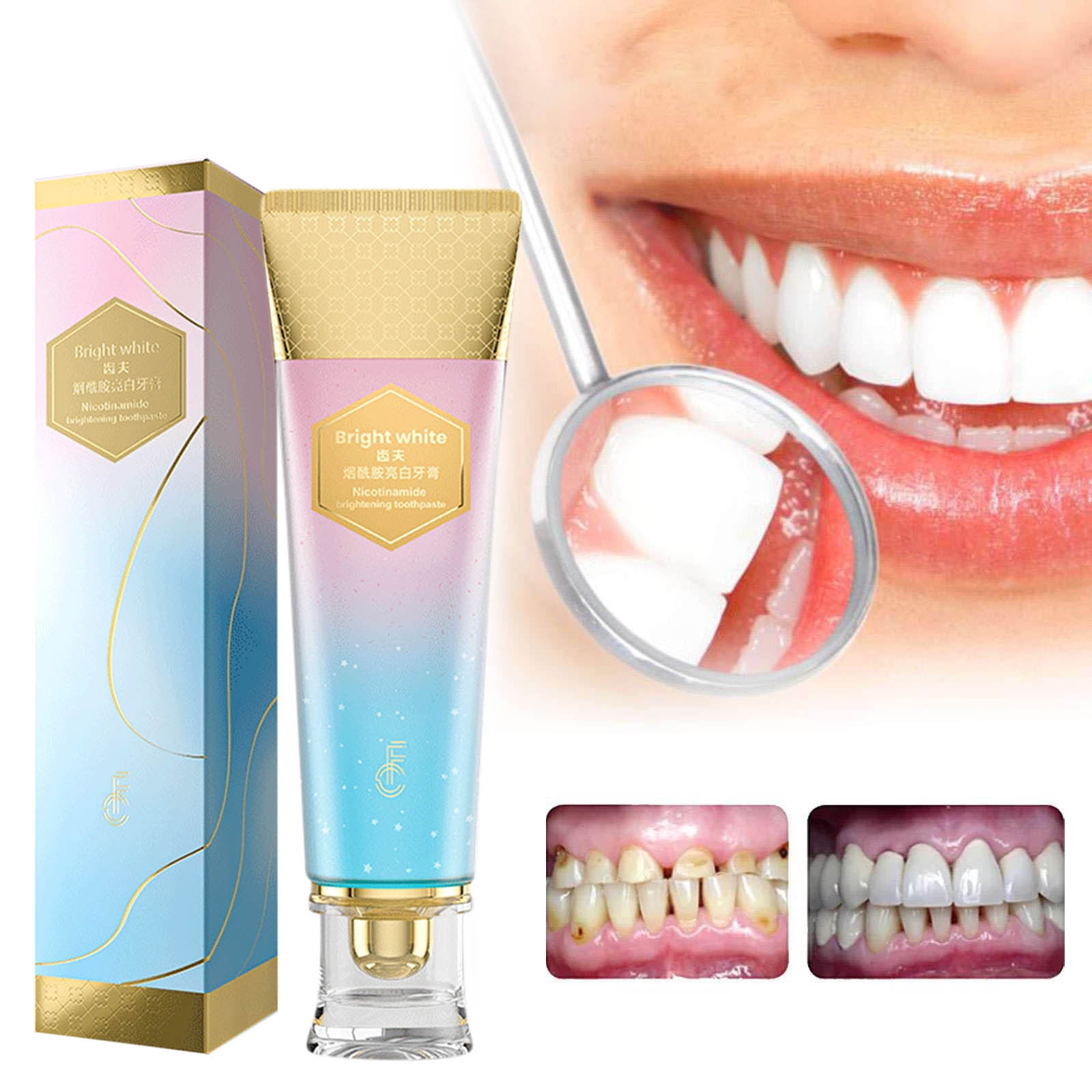 OugPiStiyk Teeth Whitening Toothpaste, Nicotinamide Whitening ...