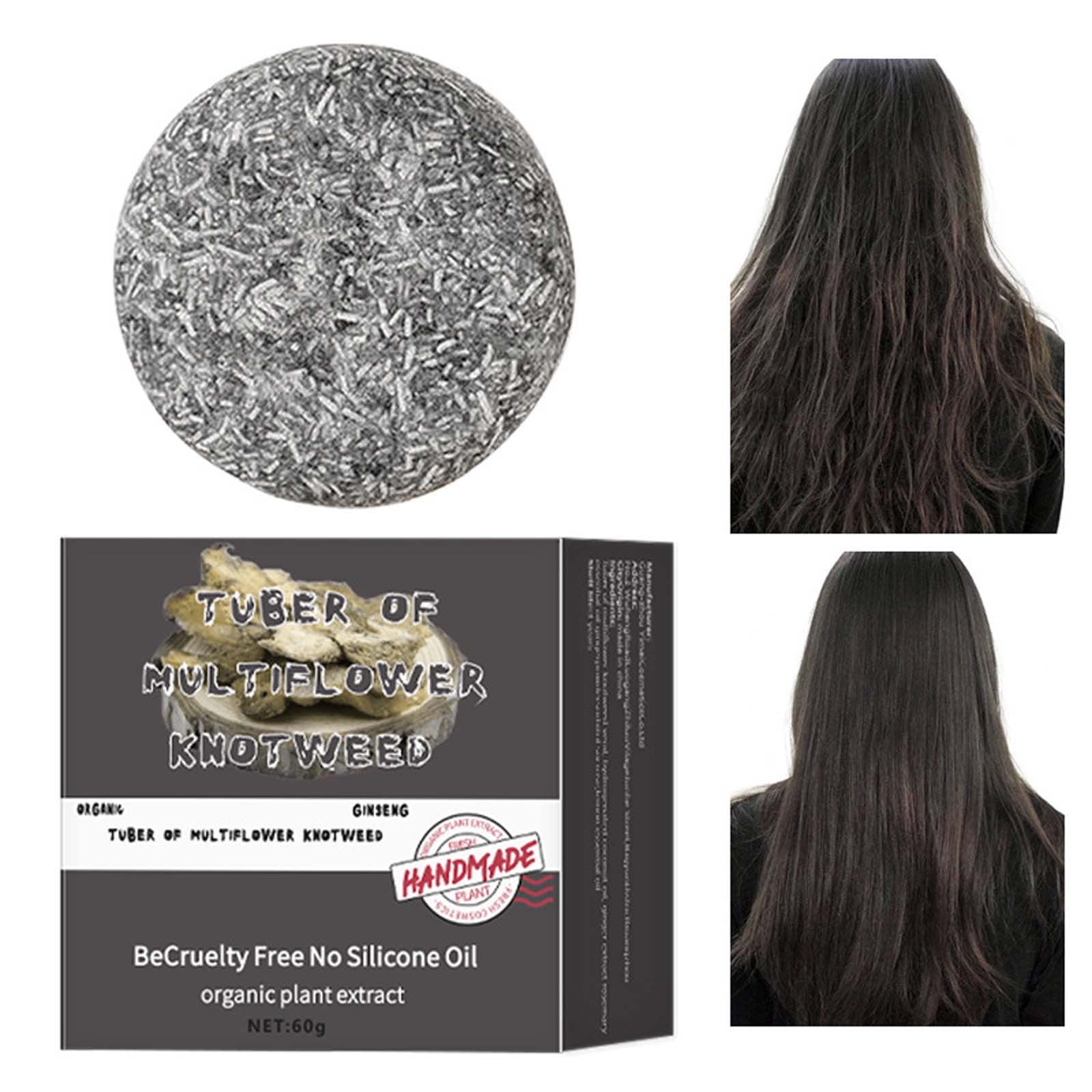 Ozmmyan Oil Control Soap Moisturizes Hair Roots, Eliminates Mites, Mild ...