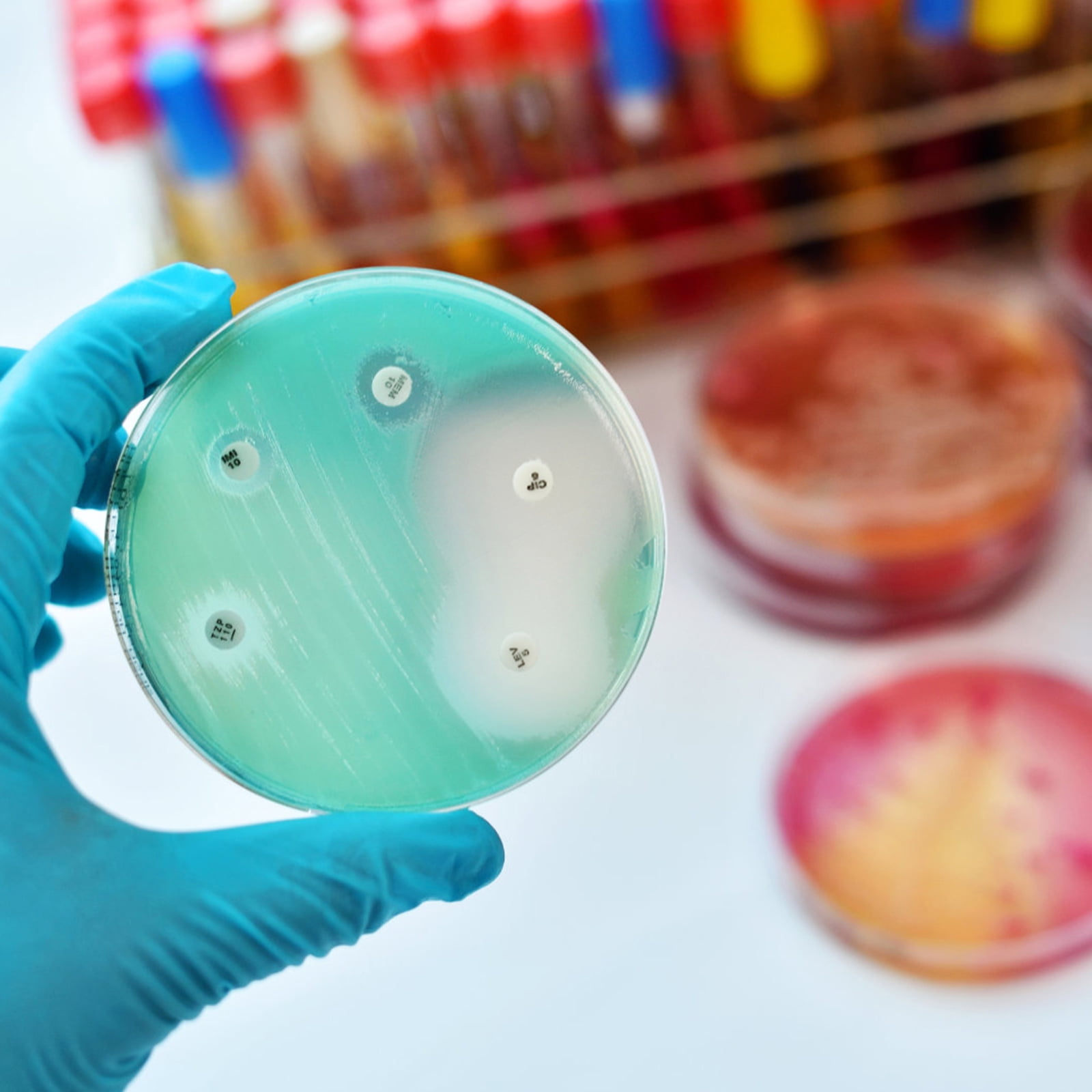 PAMINGONO 30Pack Easy to Clean Circular Petri Plates with Lid for ...