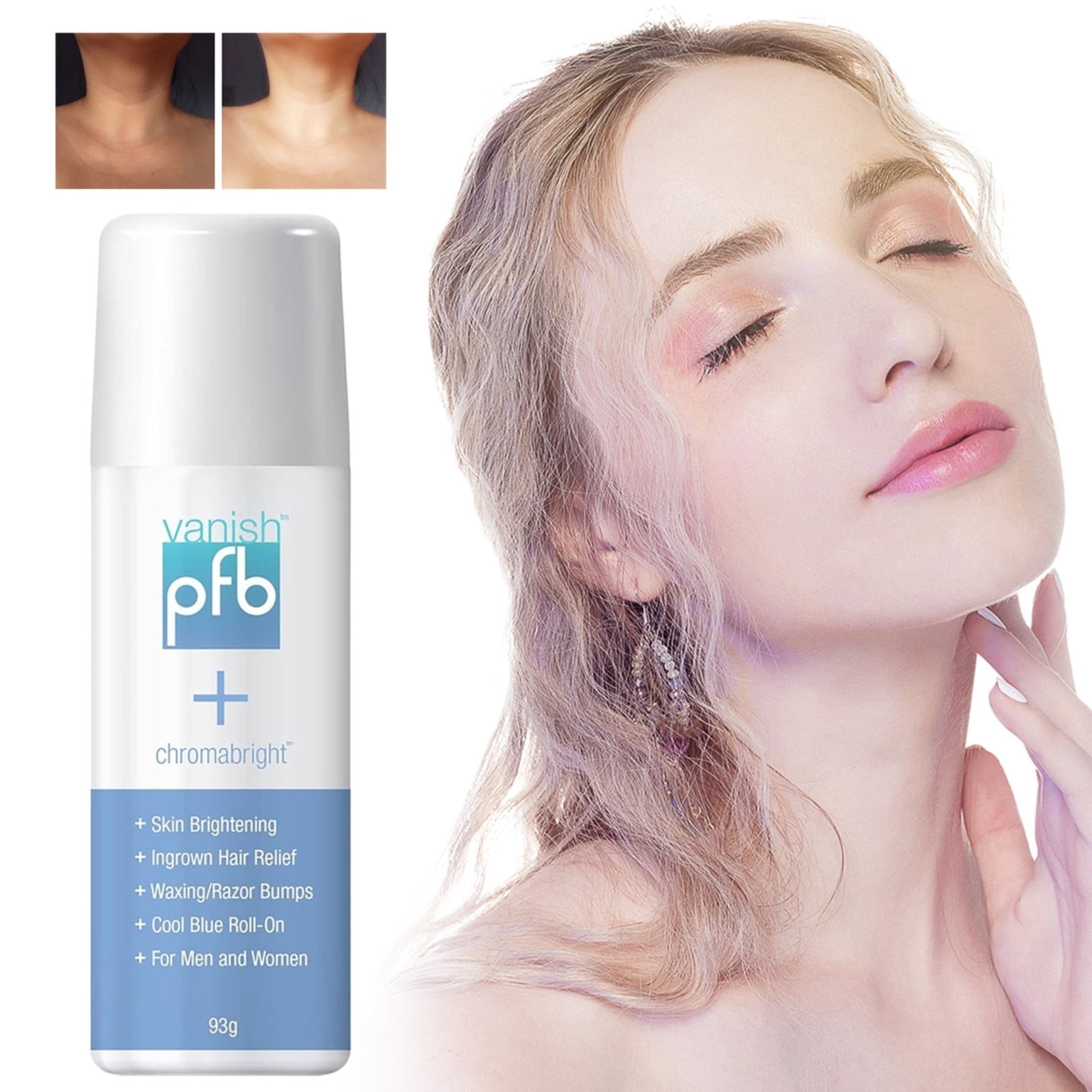 PFB Vanish Roll-On Treatment - For Ingrown Hairs & Razor Bumps | Dark ...