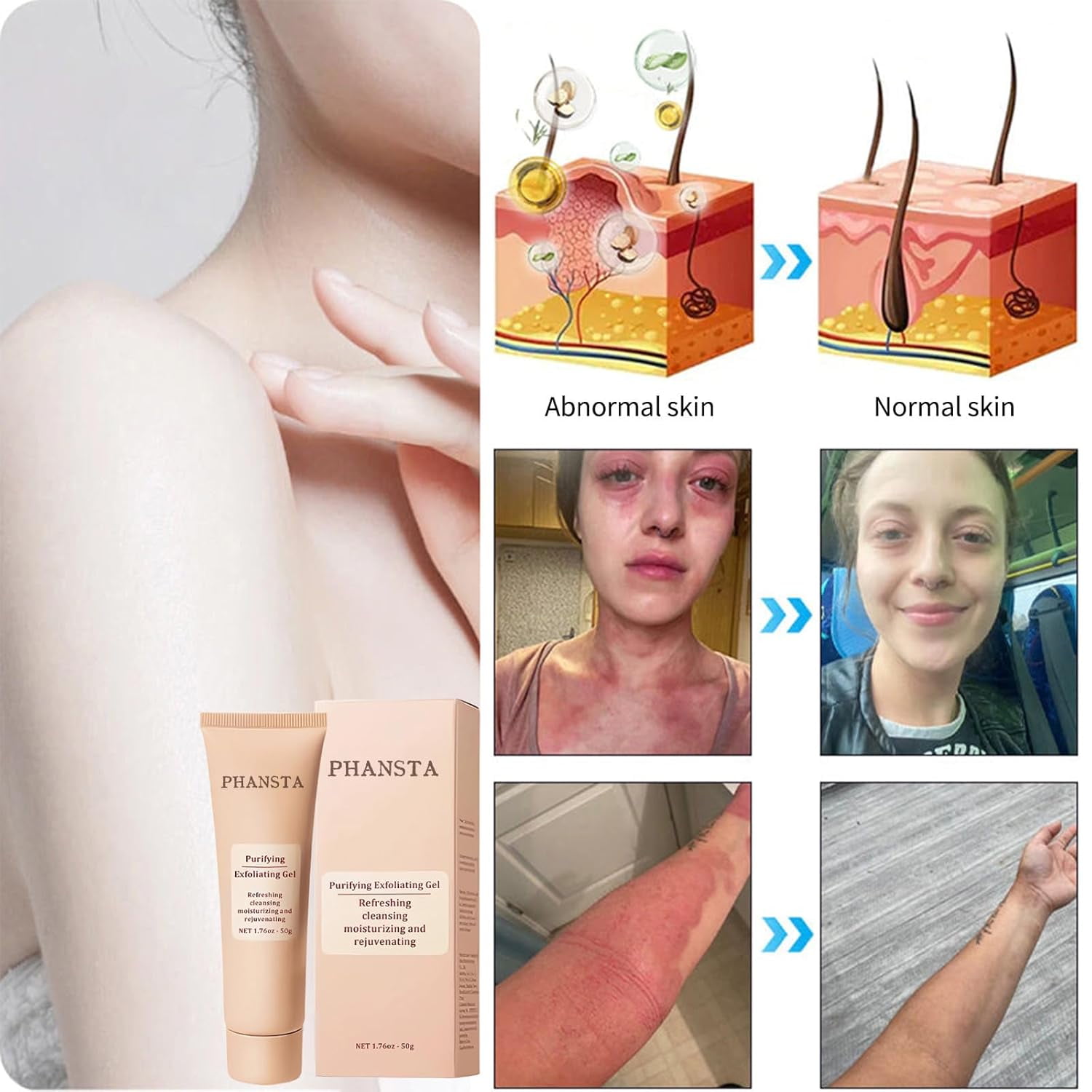 Phansta Purifying Exfoliating Gel, Phansta Purifying Enzymes Exfoliating Gel, 2025 New Upgrade ...