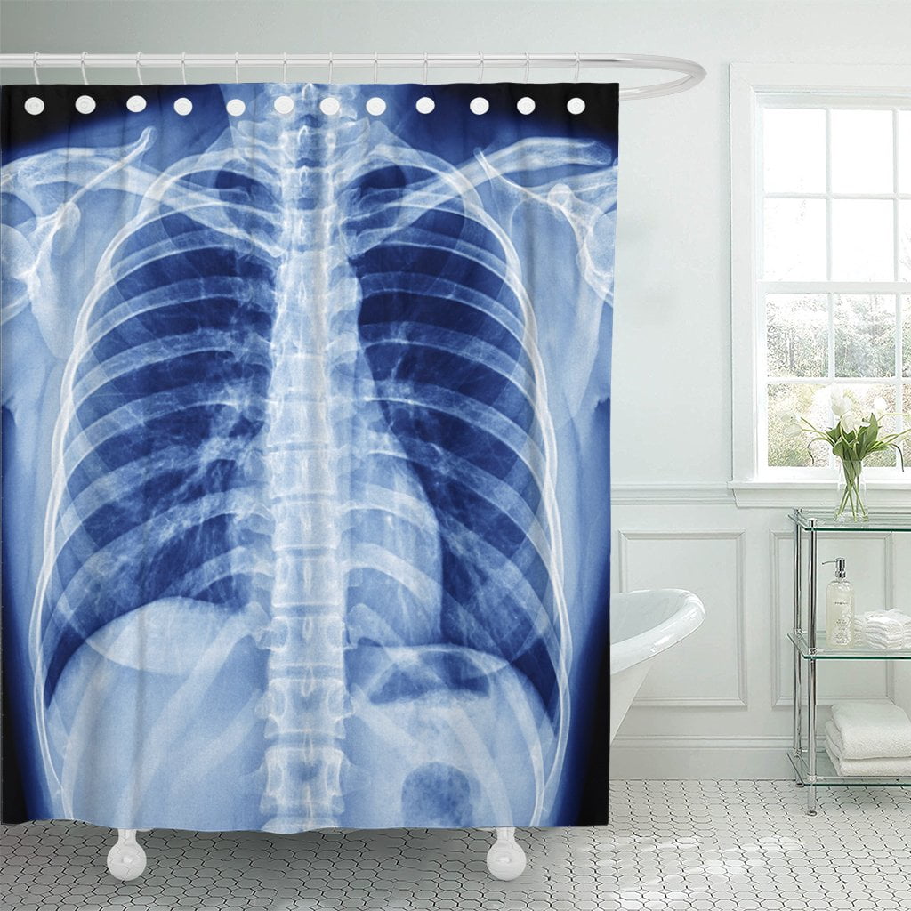 PKNMT XrayxRay Radiology Spine Skeleton Radiography Human Shower ...