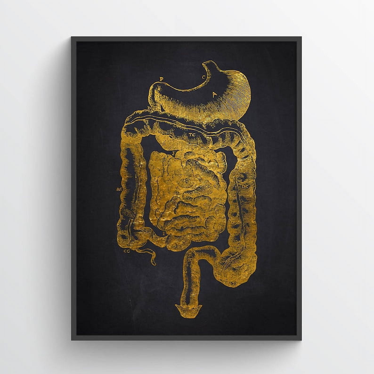 POSTER Digestive Tract Anatomy Print, Intestine, Stomach Art, Medical ...