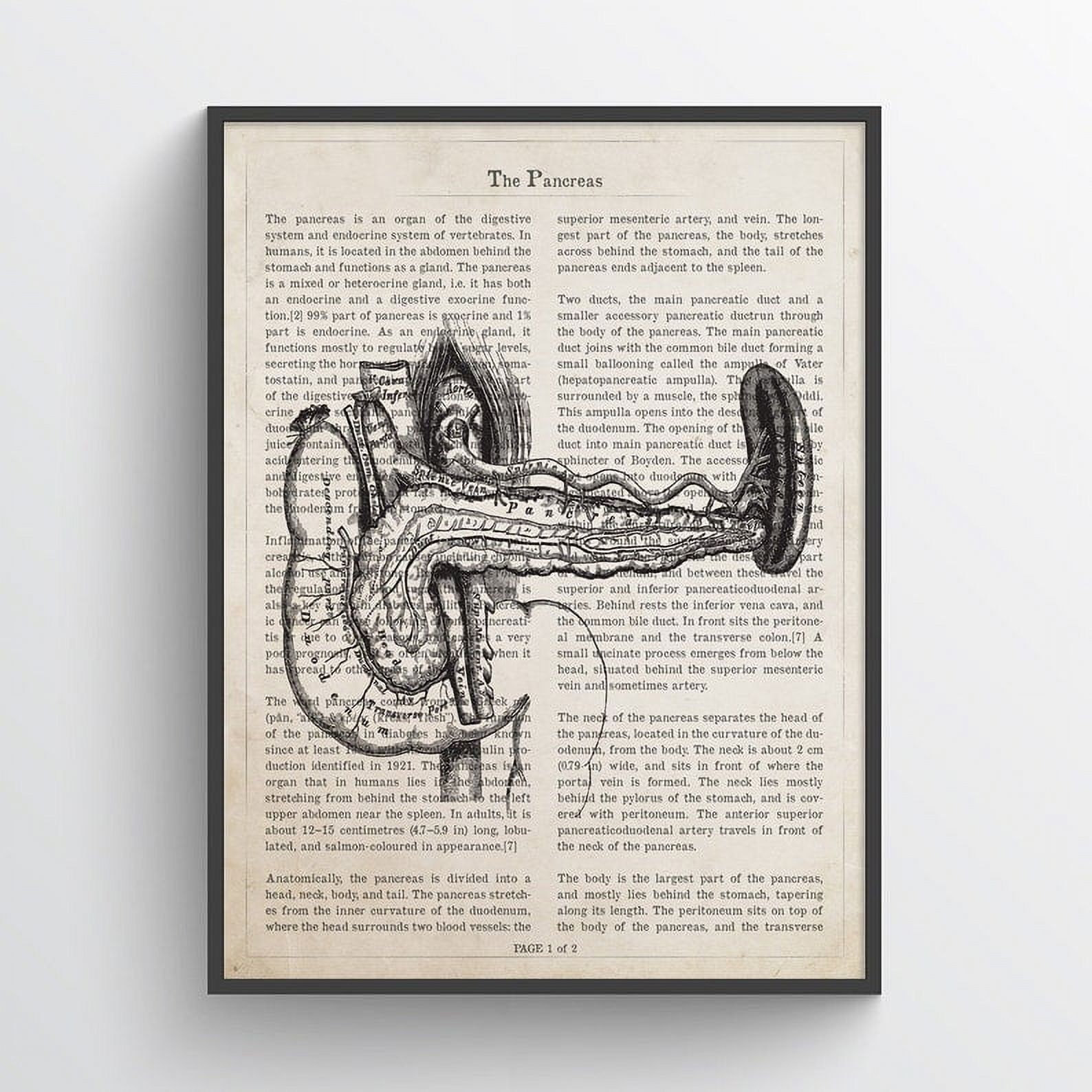 POSTER Pancreas Anatomy Print, Gastroenterologist Gift, Primary Care ...