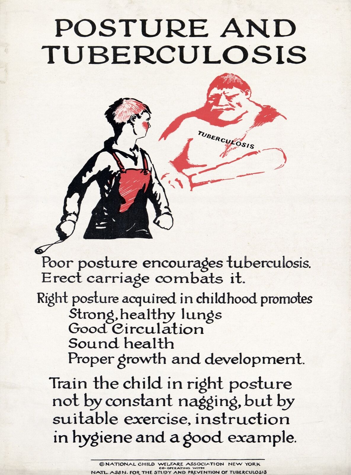 POSTER Wall Decor Poster.Home room interior art design.Tuberculosis and ...