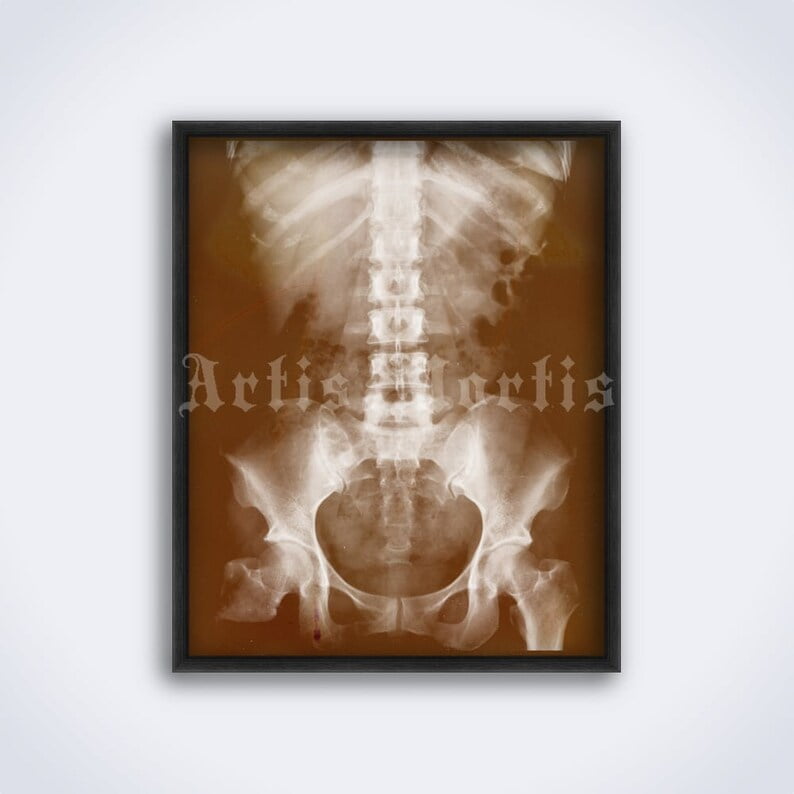 POSTER X-Ray Skeleton torso bones - anatomy, radiology photo, vintage ...