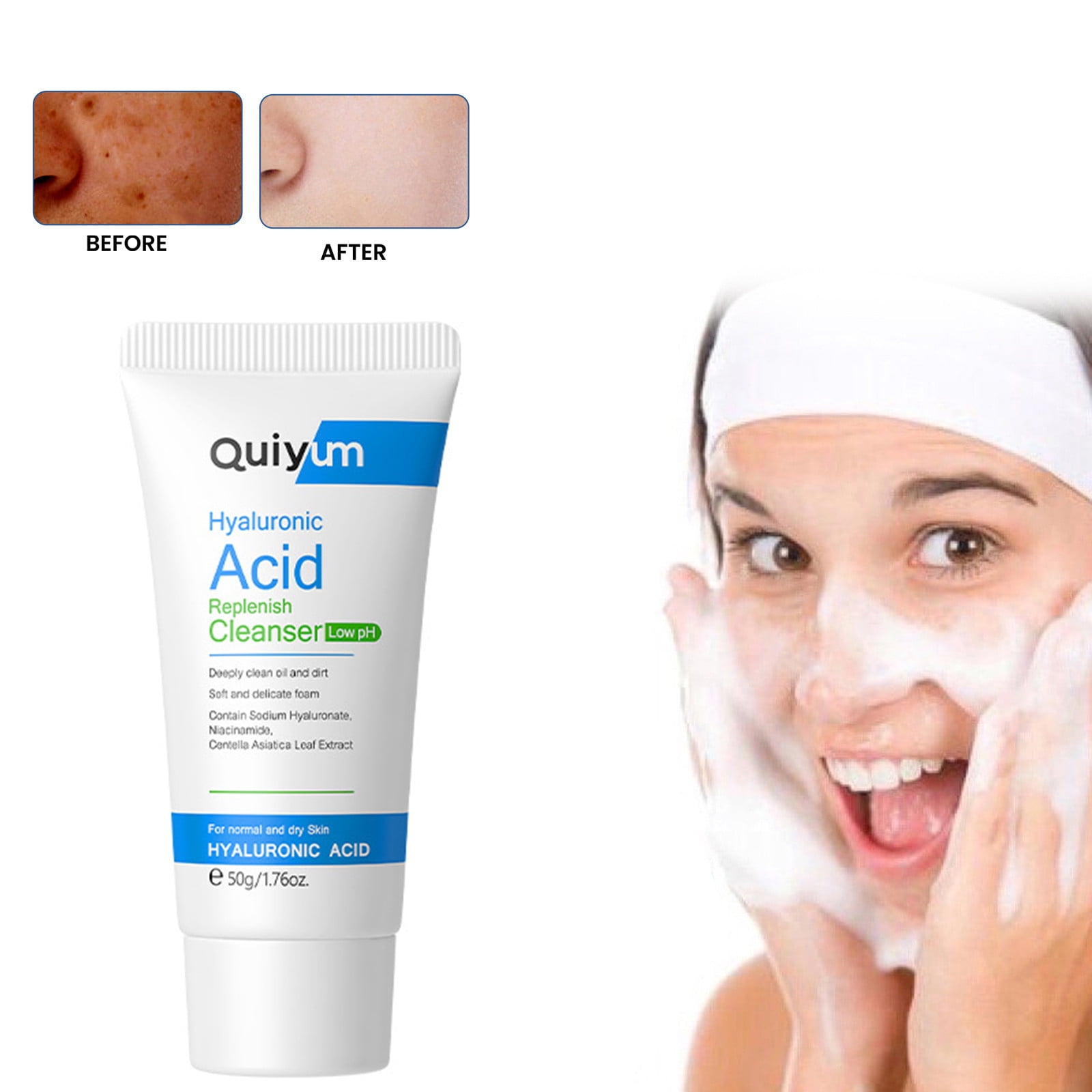 PPgejGEK Facial Cleanser Penetrate Into Pores, Dirt and Aged Keratin ...