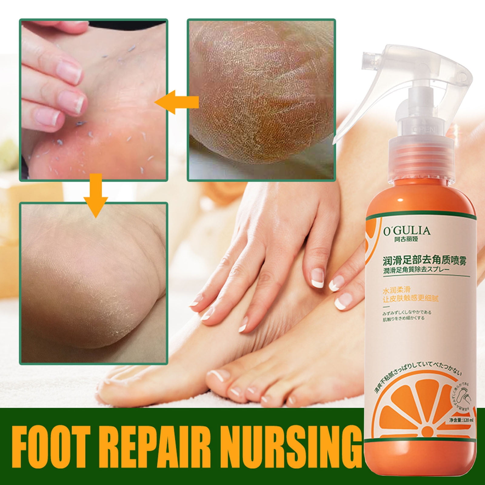 PPgejGEK Foot Wound Tissue Recovery Quick Spray To Keep The Foot Skin ...