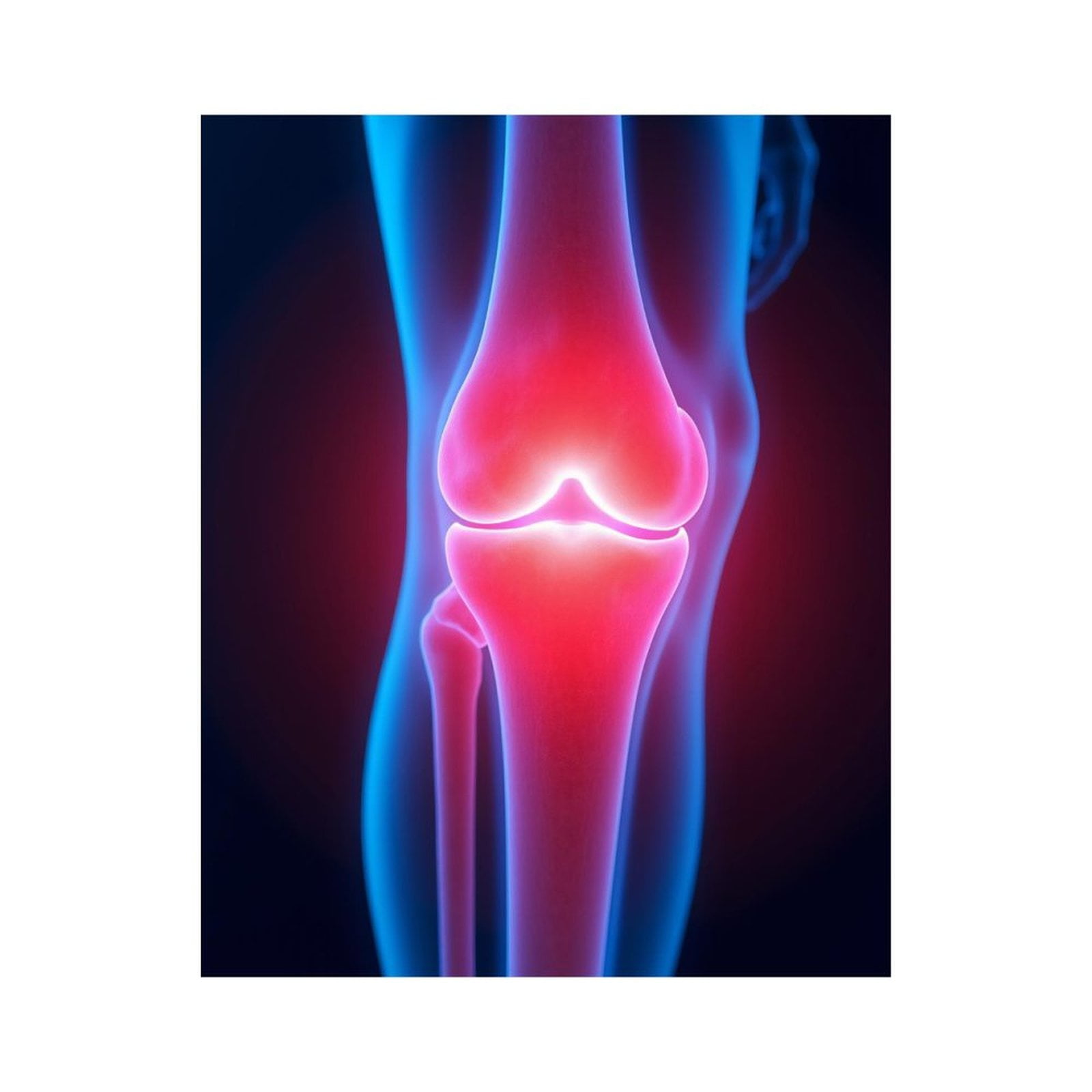 Paint by Numbers Kit for Adults, Knee Joint Anatomy Highlighted Pain ...