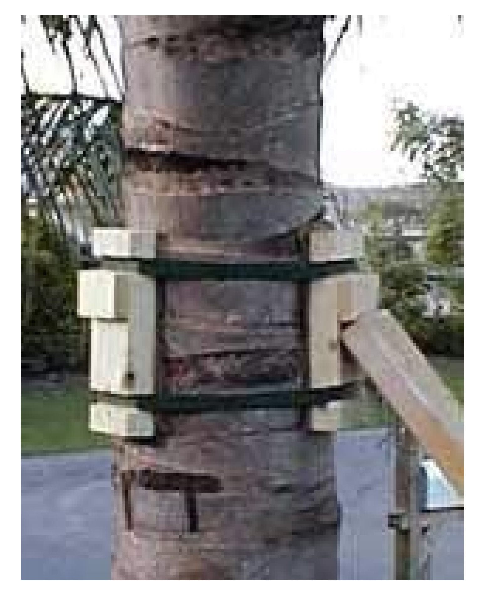 Palm Tree Brace - Walmart Business Supplies