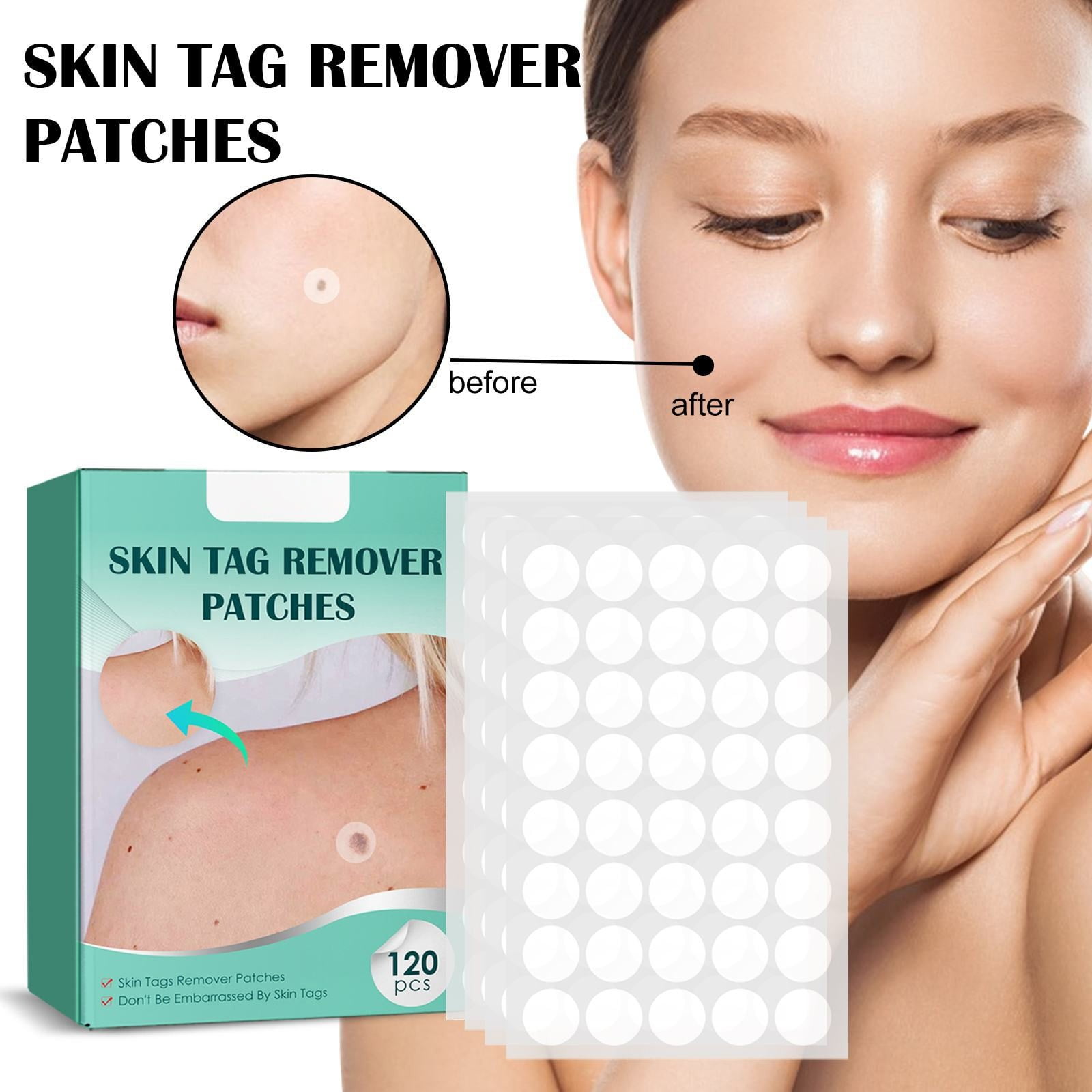 Pangliang Pox Patch & Nose patch,Anti Wart Paste Smooth Skin ...