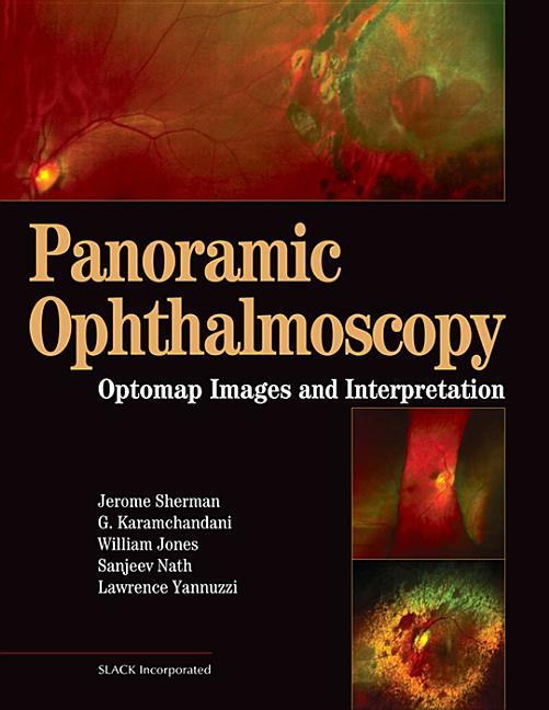 Panoramic Ophthalmoscopy : Optomap Images and Interpretation (Hardcover ...