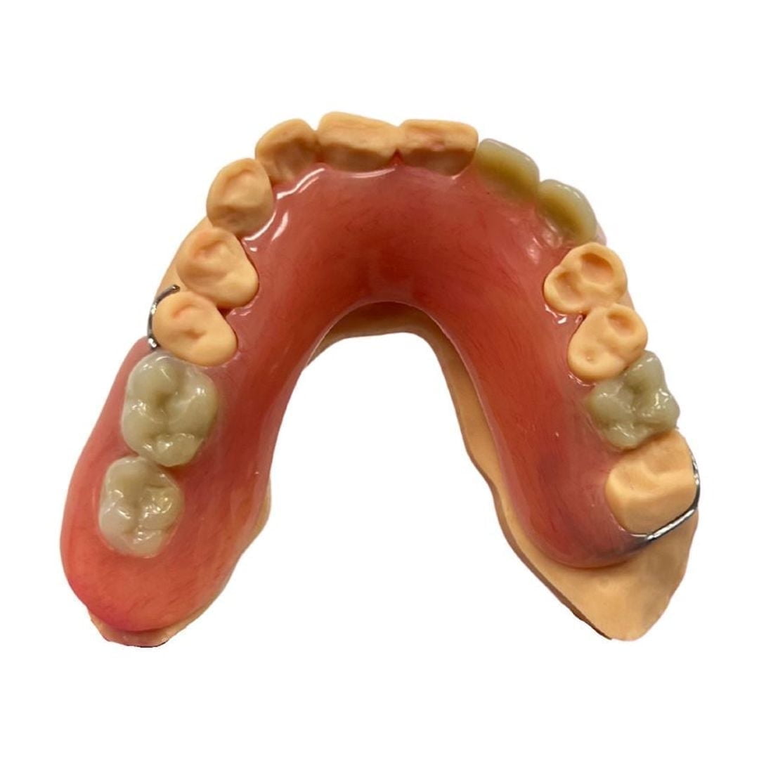 Partial Denture – Custom Acrylic & Flexible Options for 1 to 8 Missing ...